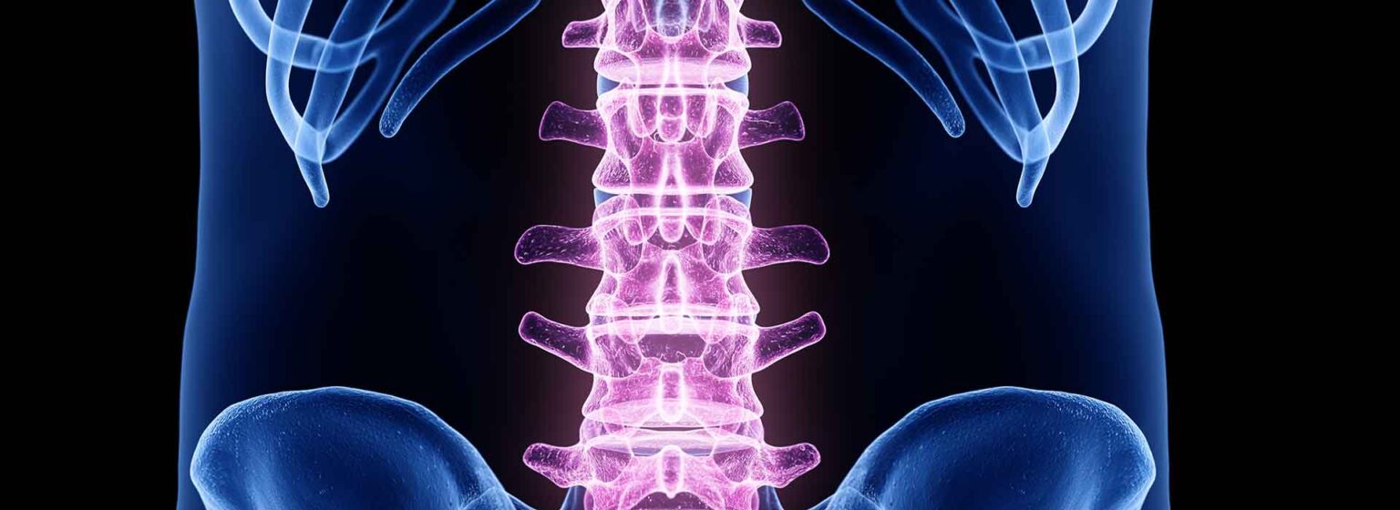 Spinal Implants & PEEK Device Applications | Genesis Medical Plastics