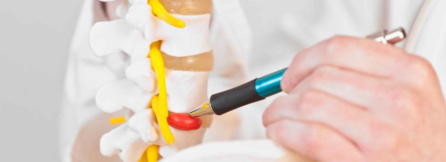 Spinal Implants & PEEK Device Applications | Genesis Medical Plastics